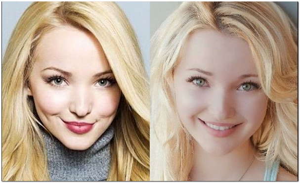 Take a Peek at Dove Cameron’s Before Plastic Surgery Photos and Notice ...